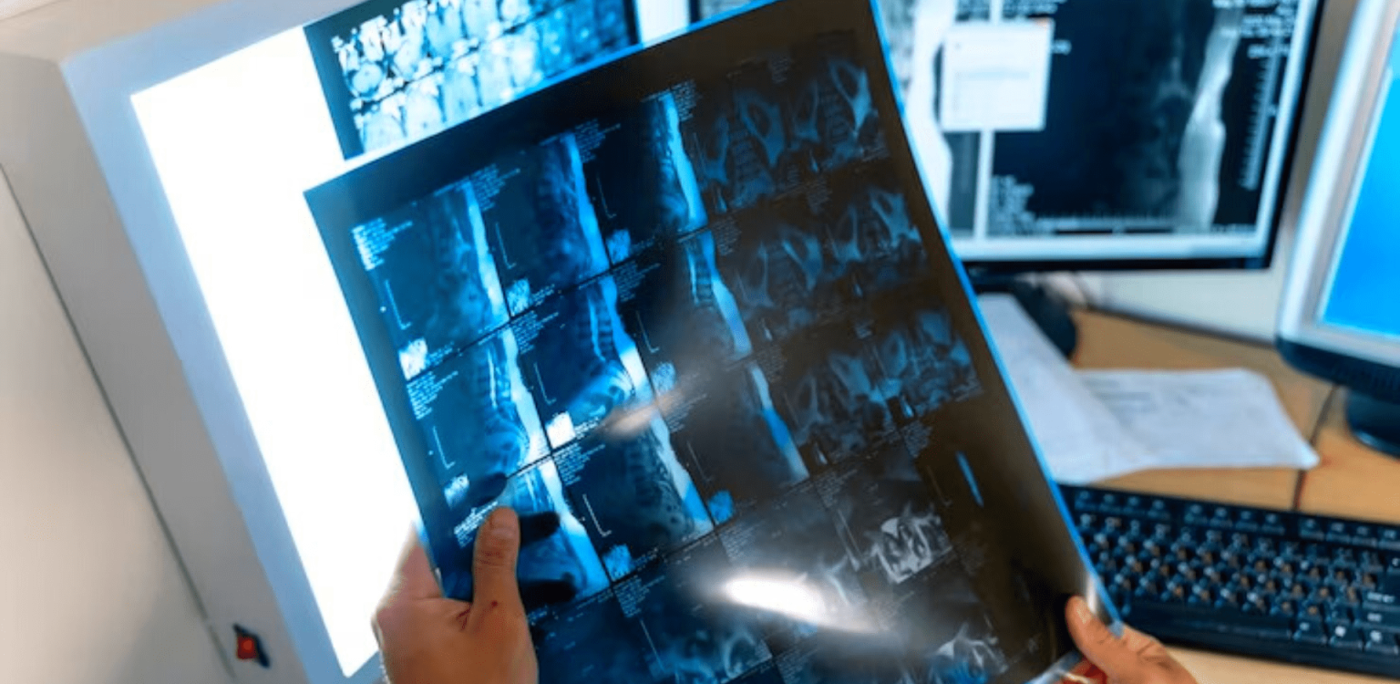 RIS na Radiologia: Transformando o Diagnóstico e Gestão de Imagens